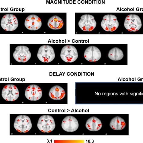 Probabilistic Delay Discounting Task Pdd With Flow For Fmri