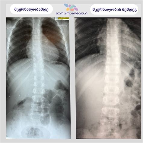 Geo Hospitals • ჯეო ჰოსპიტალსი