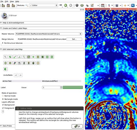 Documentation Extensions WindowLevelEffect Slicer Wiki