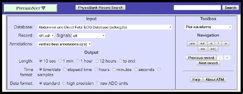 Figure 1 From Hybrid Feature Extraction Technique For Electrocardiograph Arrhythmia Signal