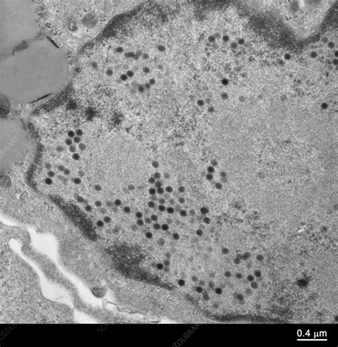 Adenovirus Tem Stock Image C0556228 Science Photo Library