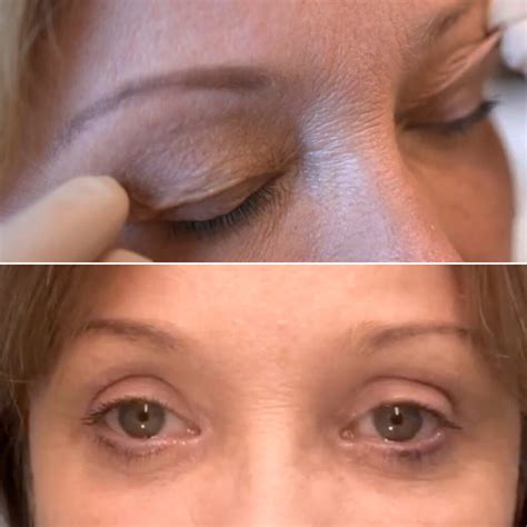 Пластична хірургія Офтальміка Естетікс