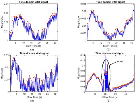 Ir Uwb Radar Based Robust Heart Rate Detection Using A Deep Learning Technique Intended For