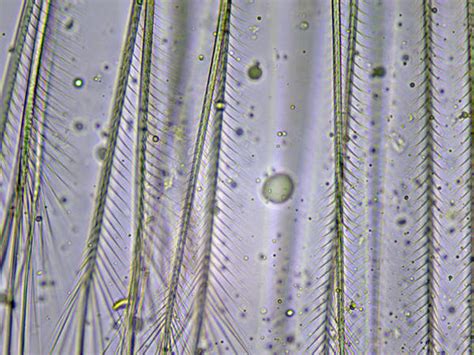 Sphaeroma Serratum Doris