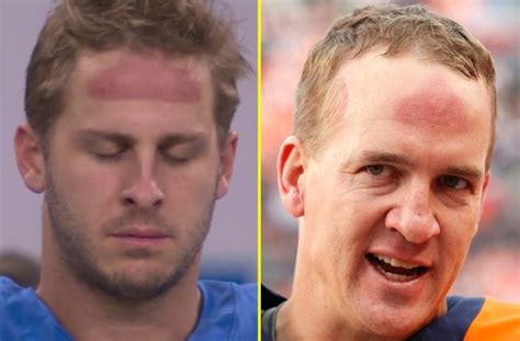 How Big Is Peyton Mannings Forehead