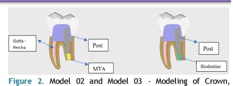 Figure 1 From Finite Element Stress Analysis In Mandibular Molars With Apical Root Resorption