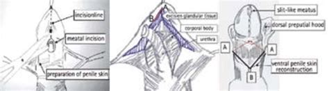 fig 3 fig 4 diagrammatic representation of memo technique download