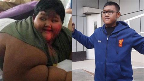 Dulu Viral Alami Obesitas Kabar Terbaru Arya Permana Yang Turunkan