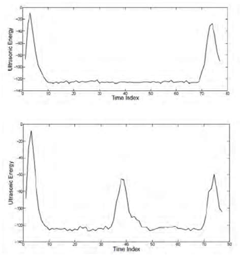 Two Ultrasound Signals The Signal On Top Is Relative To A Download Scientific Diagram