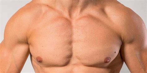 Gynecomastia Vs Fat How To Tell The Difference Between Glandular