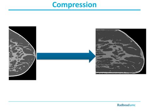 Inverse Problems In Medical Imaging Pptx