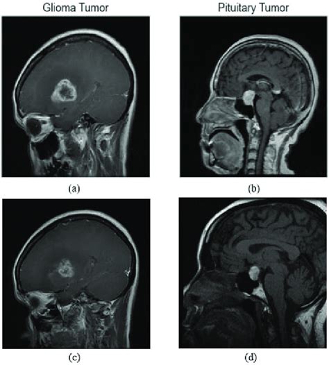 Four Samples Of Brain Mri Images From The Dataset Used A And C Download Scientific Diagram
