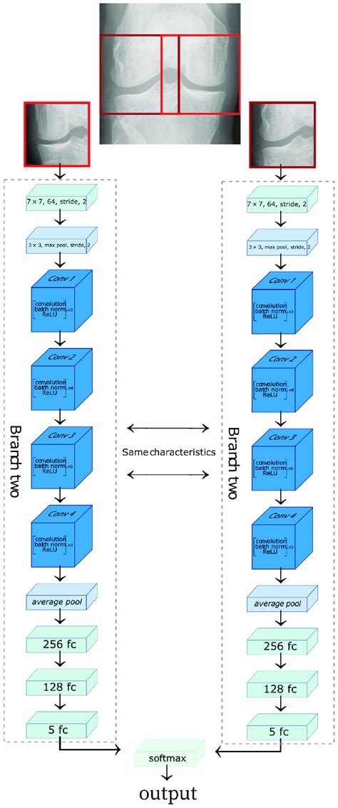 Representation Of The Siamese Network Architecture The Lateral Side Of Download Scientific