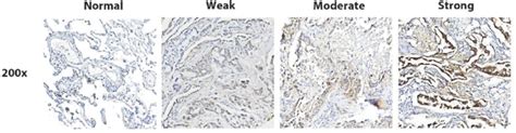 P4ha2 Expression In The Tissue Ecosystem A C E Tsne Visualization