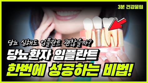 당뇨환자 임플란트 한번에 성공하는 비법 당뇨 임플란트 임플란트 부작용 임플란트 수술시 통증 줄이는법까지 Youtube