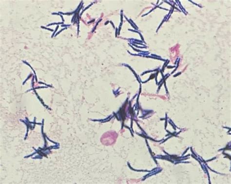 Salhi Marouane On Linkedin Mycobacterium Mucogenicum Phocaicum Group