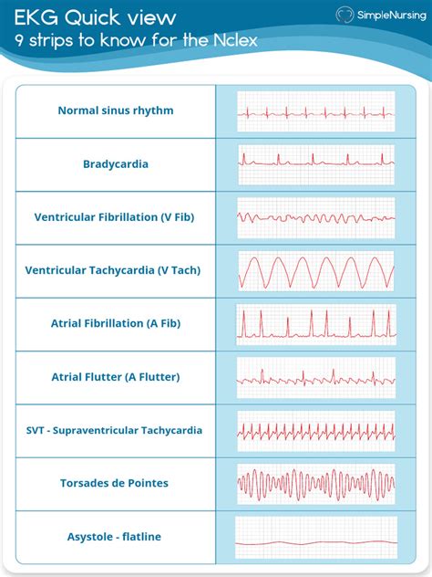 Ecg Quick View Pdf