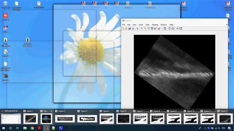 Automatic Detection Of B Lines In In Vivo Lung Ultrasound In Matlab Okok Projects Final Year