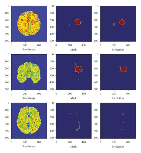 An Experimental Result Achieved With The Proposed VGG UNet A Download Scientific Diagram
