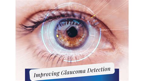 Improving Glaucoma Detection