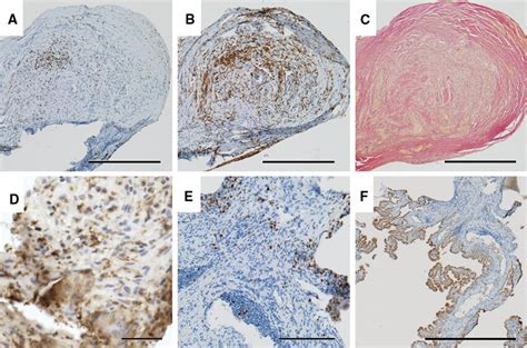 Representative Sections Of Choroid Plexus Tissue Plug Extracted From A Download Scientific Representative Sections Of Choroid Plexus Tissue Plug Extracted From A Download Scientific