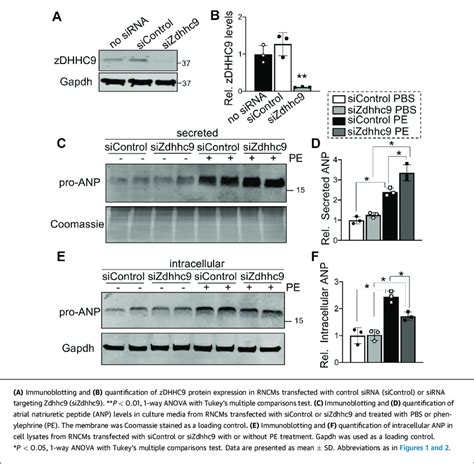 Zdhhc9 Depletion Enhances Phenylephrine Induced Atrial Natriuretic