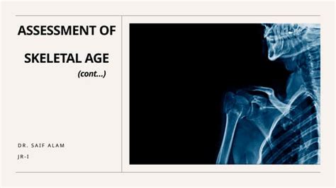Skeletal Age Assessment Pptx