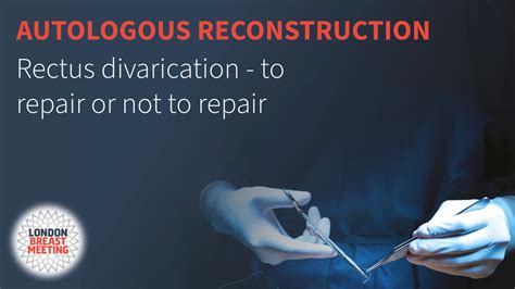 Aesthetic And Reconstructive Breast Surgery Network Rectus Divarication To Repair Or Not To