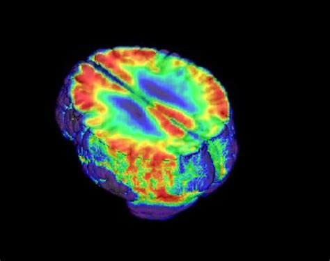 The Science Of The Aging Brain Discover Cal