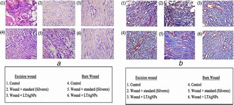 Histopathological Analysis A Photographic Representation Of Download Scientific Diagram