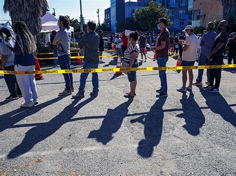 Could Swollen Lymph Nodes Be Monkeypox What To Do