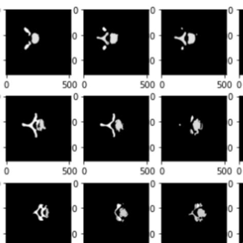 Data Pre Processing For Rsna Part 3 Kaggle Data Pre Processing For Rsna Part 3 Kaggle
