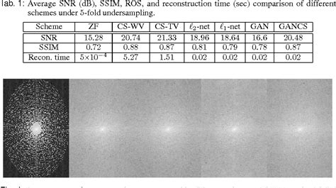Figure 4 From Deep Generative Adversarial Networks For Compressed Sensing Automates Mri