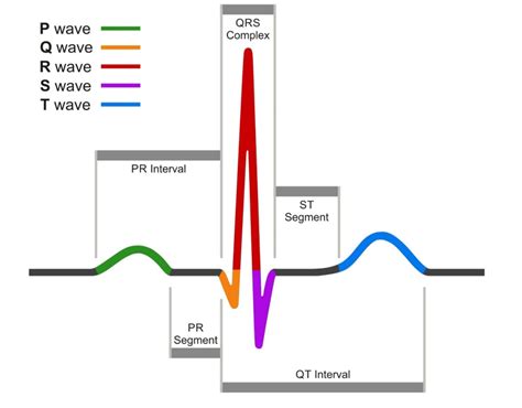 Ecg Quiz Interpreting Cardiac Waveforms