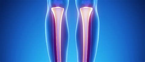 Patient Specific 3d Printed Titanium Implant For Distal Tibial Critical Bone Defect Regmednet