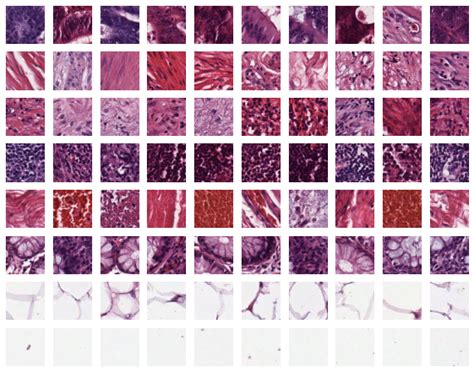 Github Io Commitshistopathology Classification