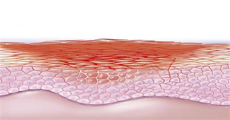 آفات نادرة تكشفها أمراض جلدية