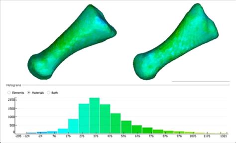 Assigned Material Properties Of Right First Metatarsal Bone And