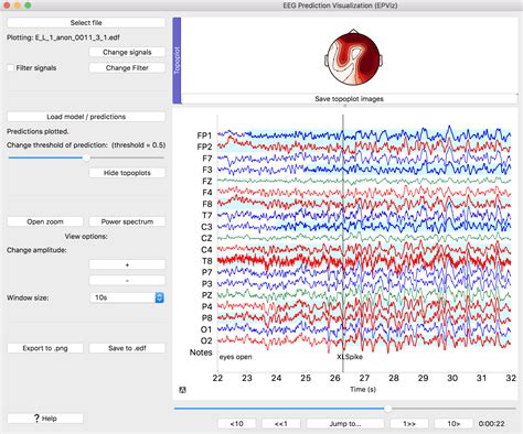 Epviz Neural Systems Analysis Laboratoryneural Systems Analysis