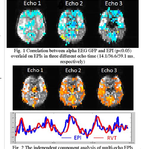 Figure 1 From Differentiating Neuronal And Non Neuronal Contributions