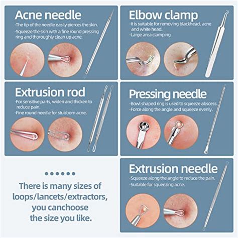 Blackhead Extractor Before And After