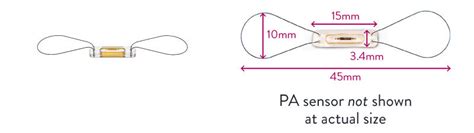 Cardiomems Hf System Procedure Overview Abbott