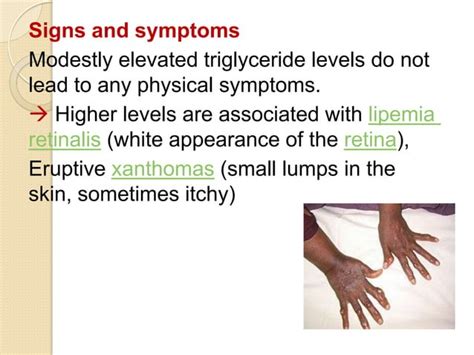 Hypertriglyceridemia Ppt Hypertriglyceridemia Ppt