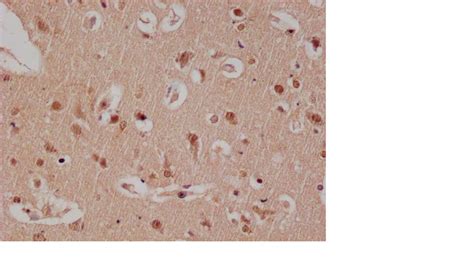 Anti E2f4 Antibody [24e12] Ab314180 Abcam