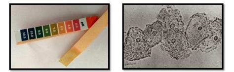 Wet Mount Showing Clue Cells 40x Cytological Findings Of