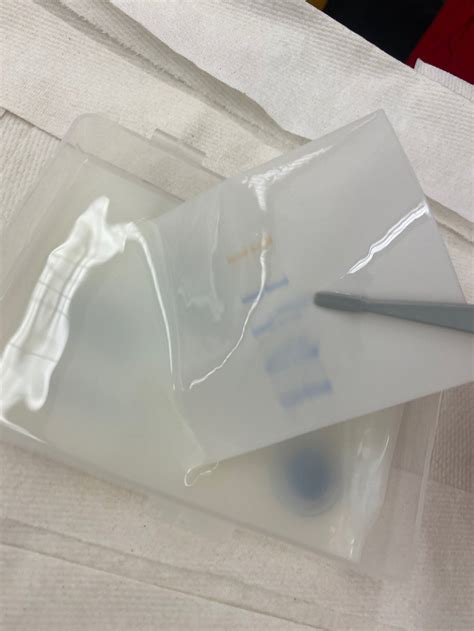 Western Blot Transfer Band Smearing Researchgate