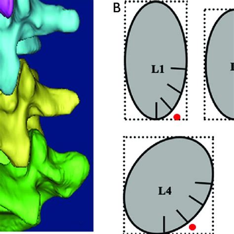 Comparison Of Traditional Pedicle Screw Trajectory And Cortical Bone Download Scientific