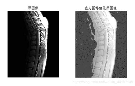计算机图像处理实验四：图像对比度调整（matlab）用matlab对图像进行常见的非线性变换并加以分析对比。 Csdn博客