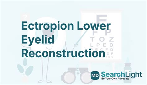 Ectropion Lower Eyelid Reconstruction Lower Eyelid Reconstruction Md Searchlight