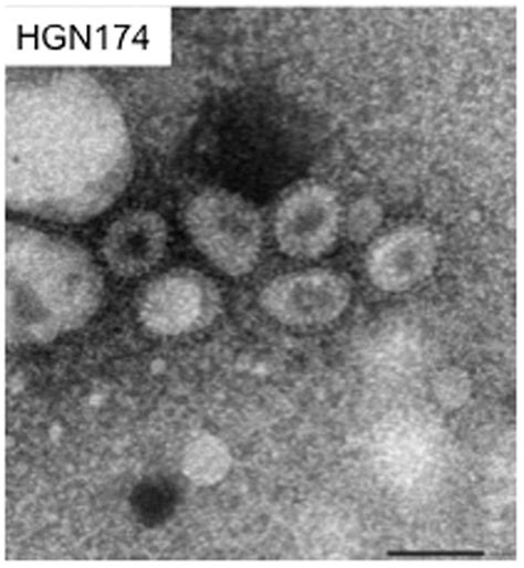 Electron Microscopy Numerous Viral Particles Were Observed In The